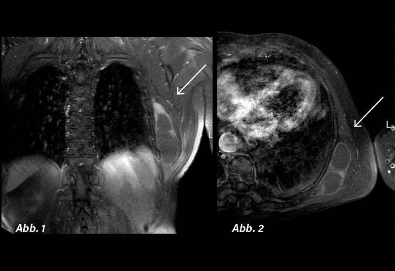 Detailansicht - Rheuma Management Magazin – Offizielles ...